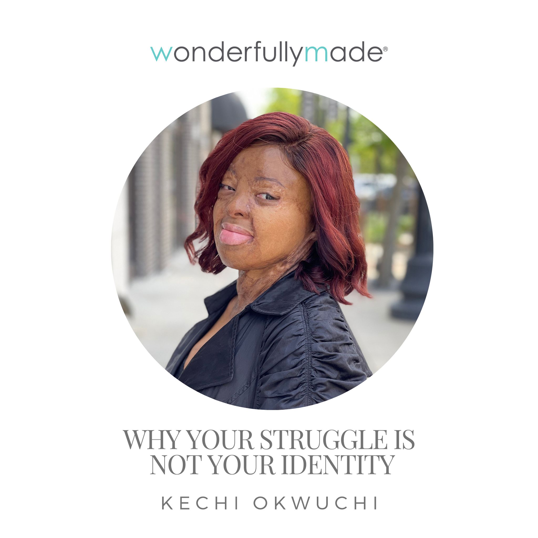 Why Your Struggle Is Not Your Identity — With Kechi Okwuchi – Wonderfully Made